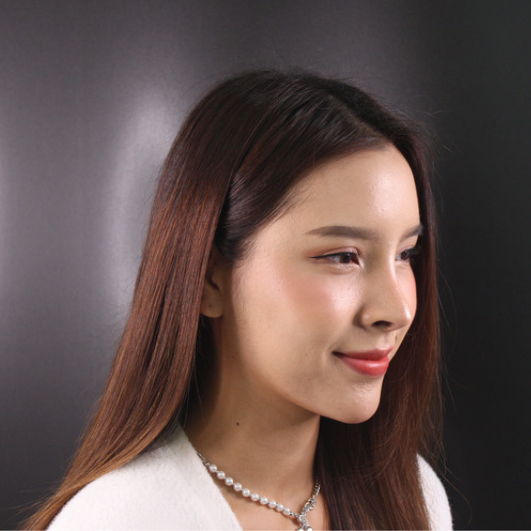 Forehead Filler Treatment | Stamp Fleur Clinic